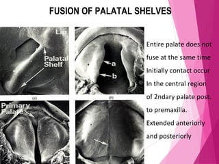Development of Palate and Tongue PPT | PPT