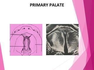 Development of Palate and Tongue PPT | PPT