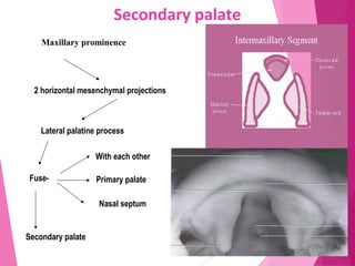 Development of Palate and Tongue PPT | PPT
