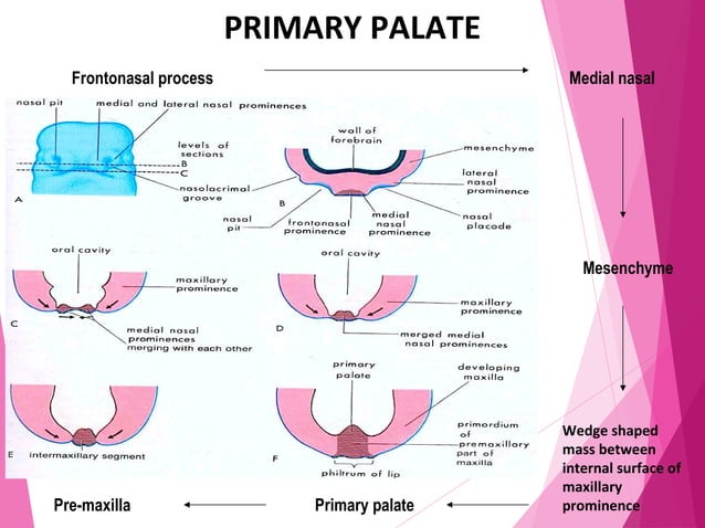 Development of Palate and Tongue PPT