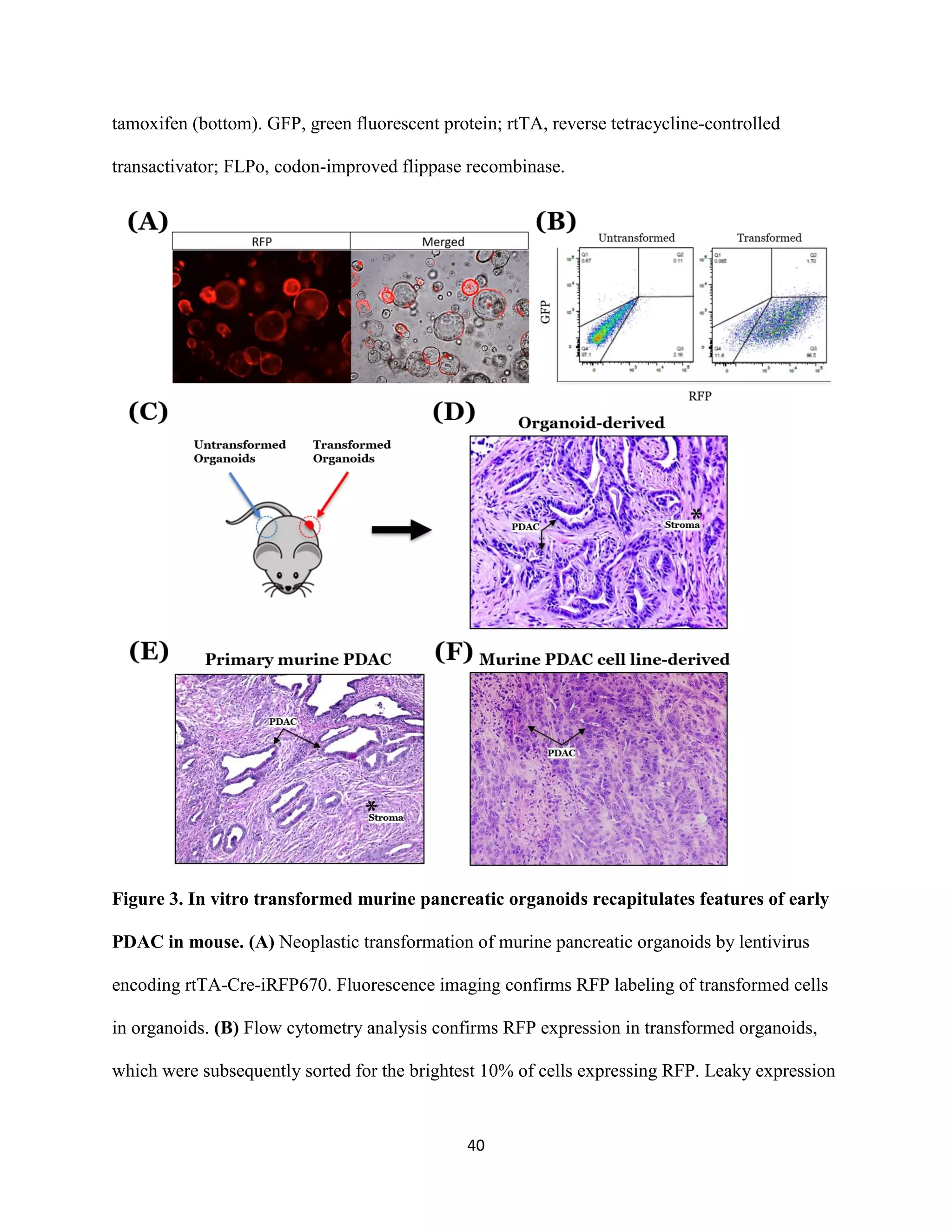 Development of pancreatic cancer organoid model for studying immune ...