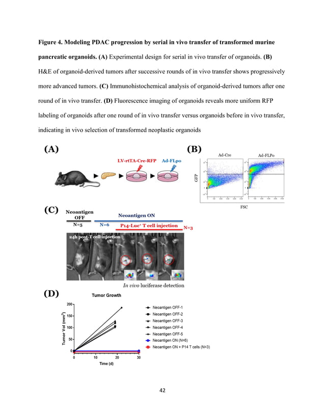 Development of pancreatic cancer organoid model for studying immune ...
