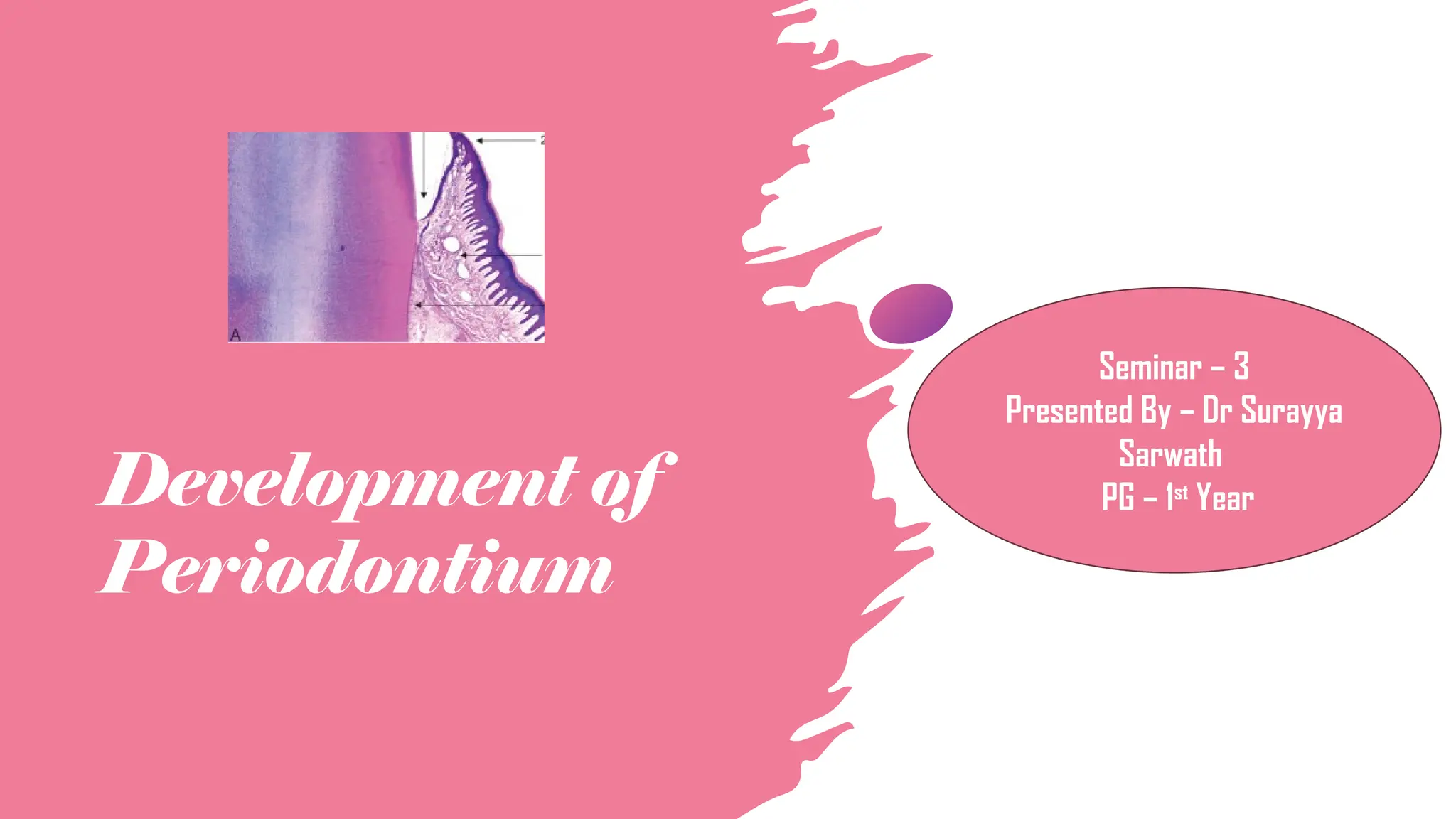 Development of Periodontium. focuses on development of periodontal ...