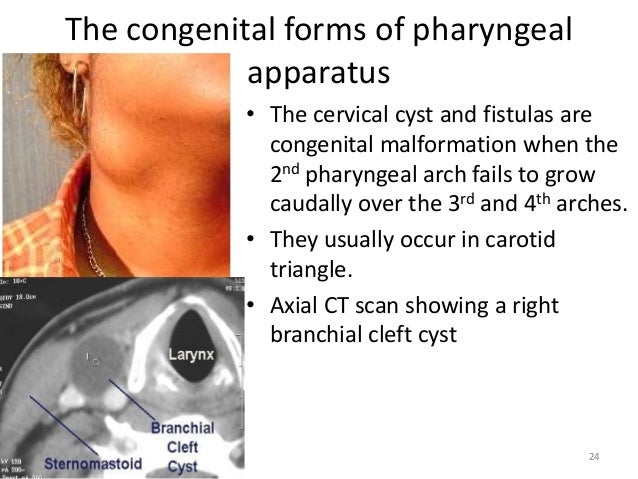 Development of pharyngeal apparatus and palate