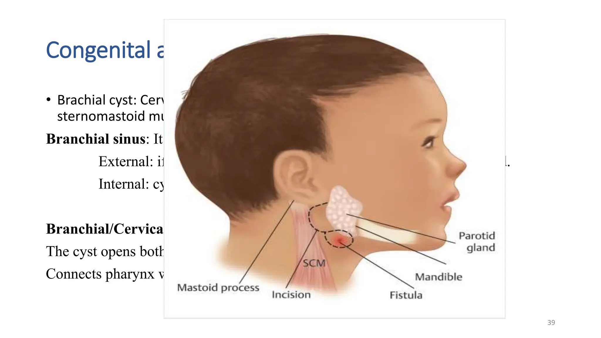 Development of pharyngeal arches, clefts and pouches.pptx