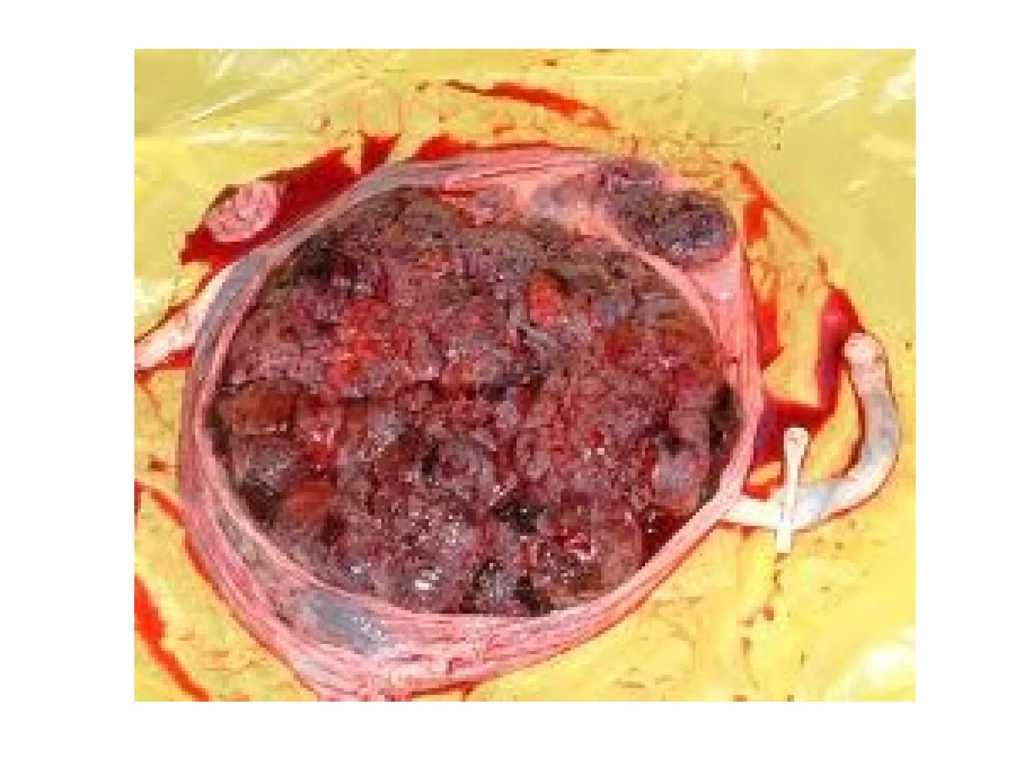 Development of placenta | PPT