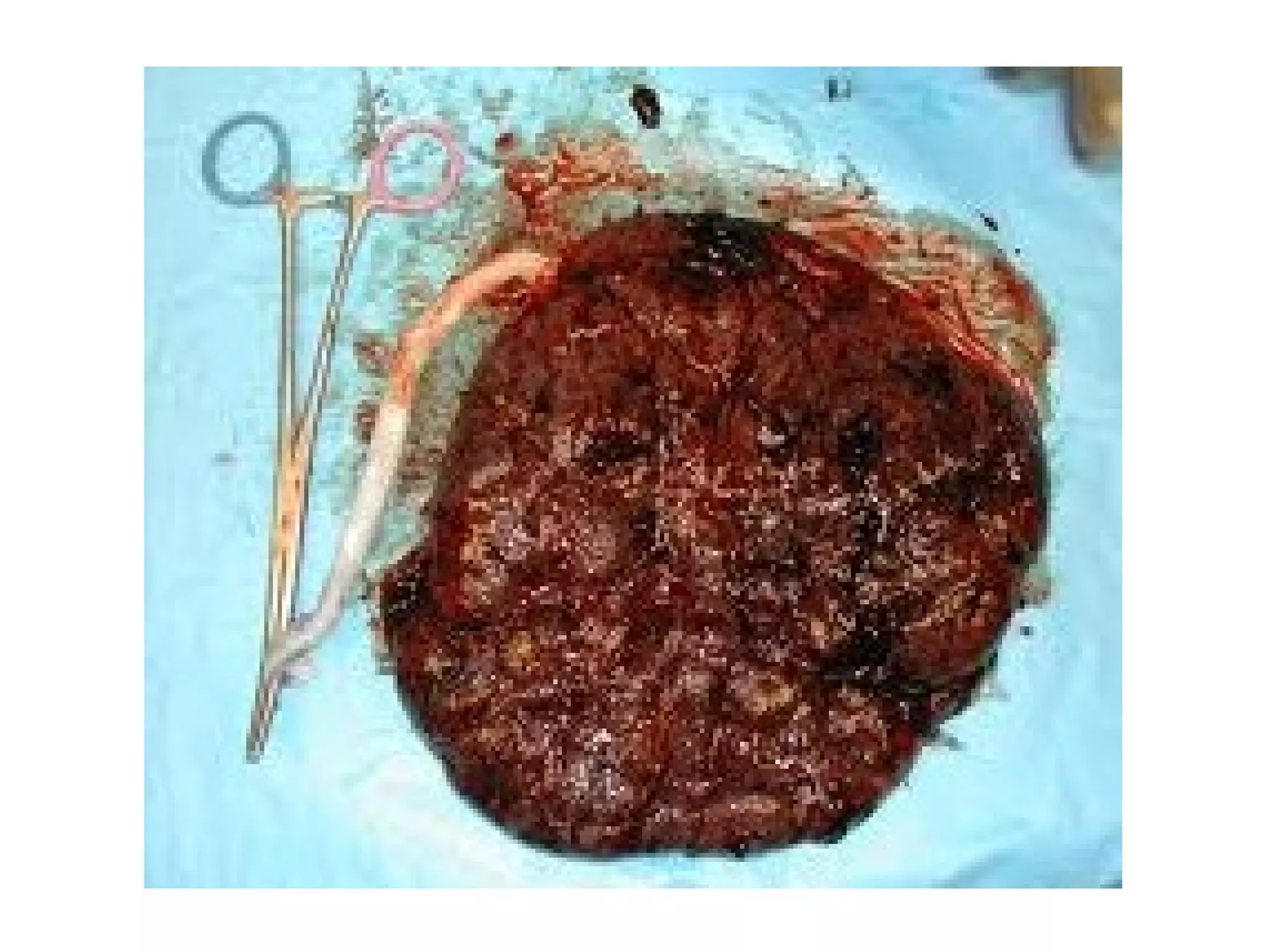 Development of placenta | PPT