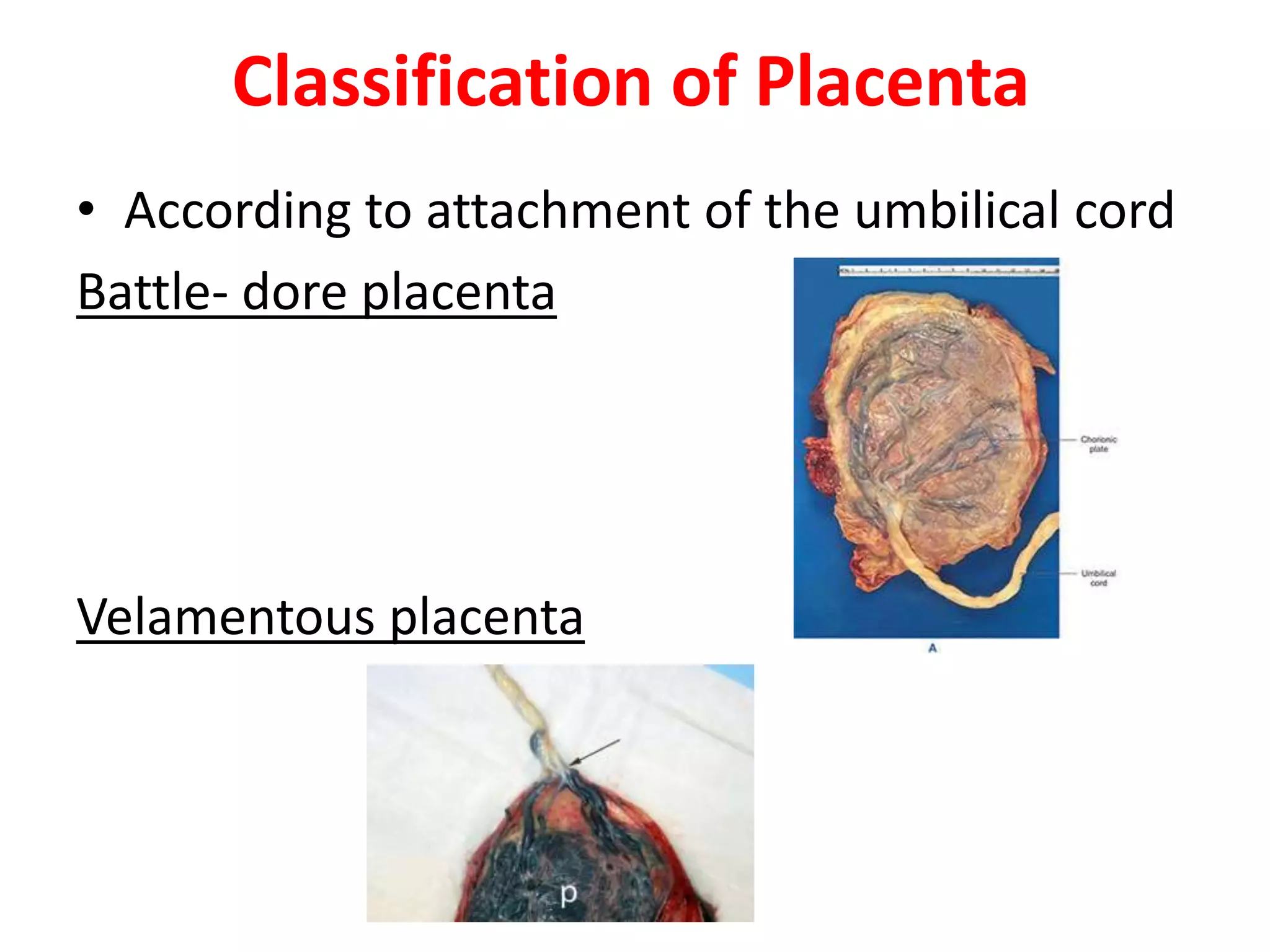 Development of Placenta.pptx