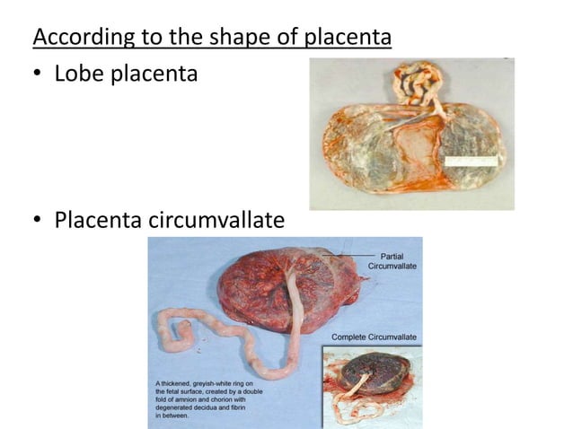 Development of Placenta.pptx | Infertility | Reproductive Health