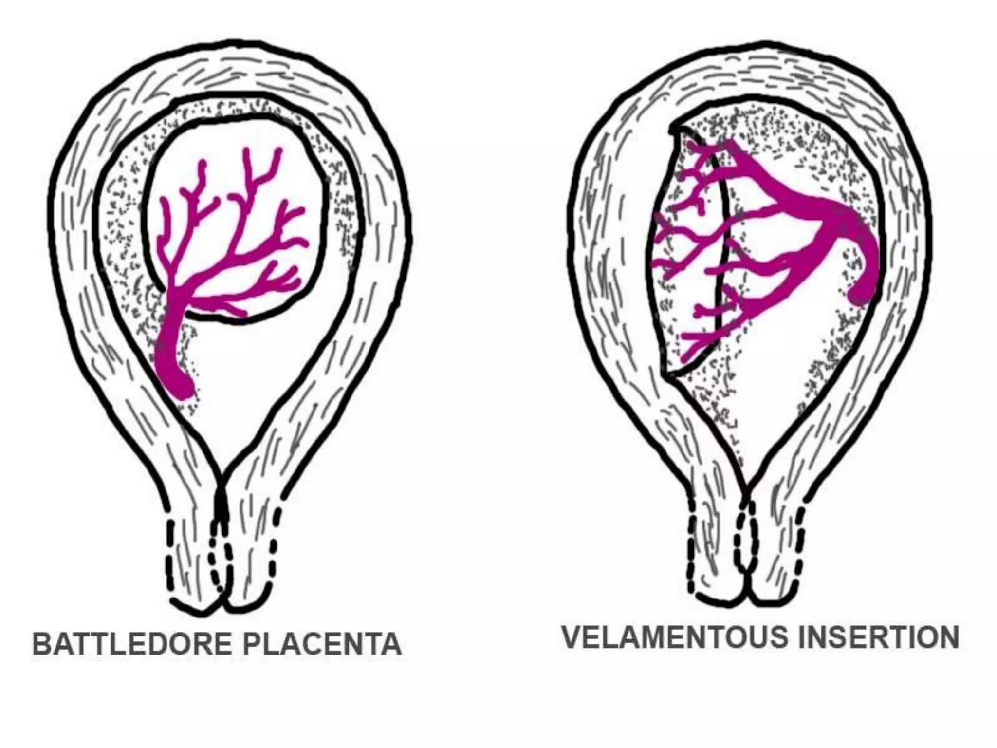 DEVELOPMENT OF PLACENTA AND FETUS.pptx