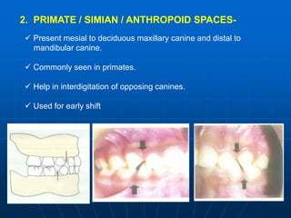 Development of primary dentition | PPT