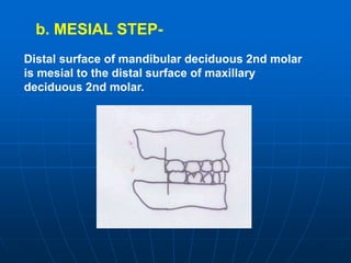 Development of primary dentition | PPT