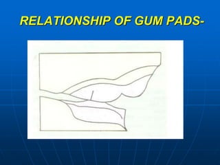 Development of primary dentition | PPT
