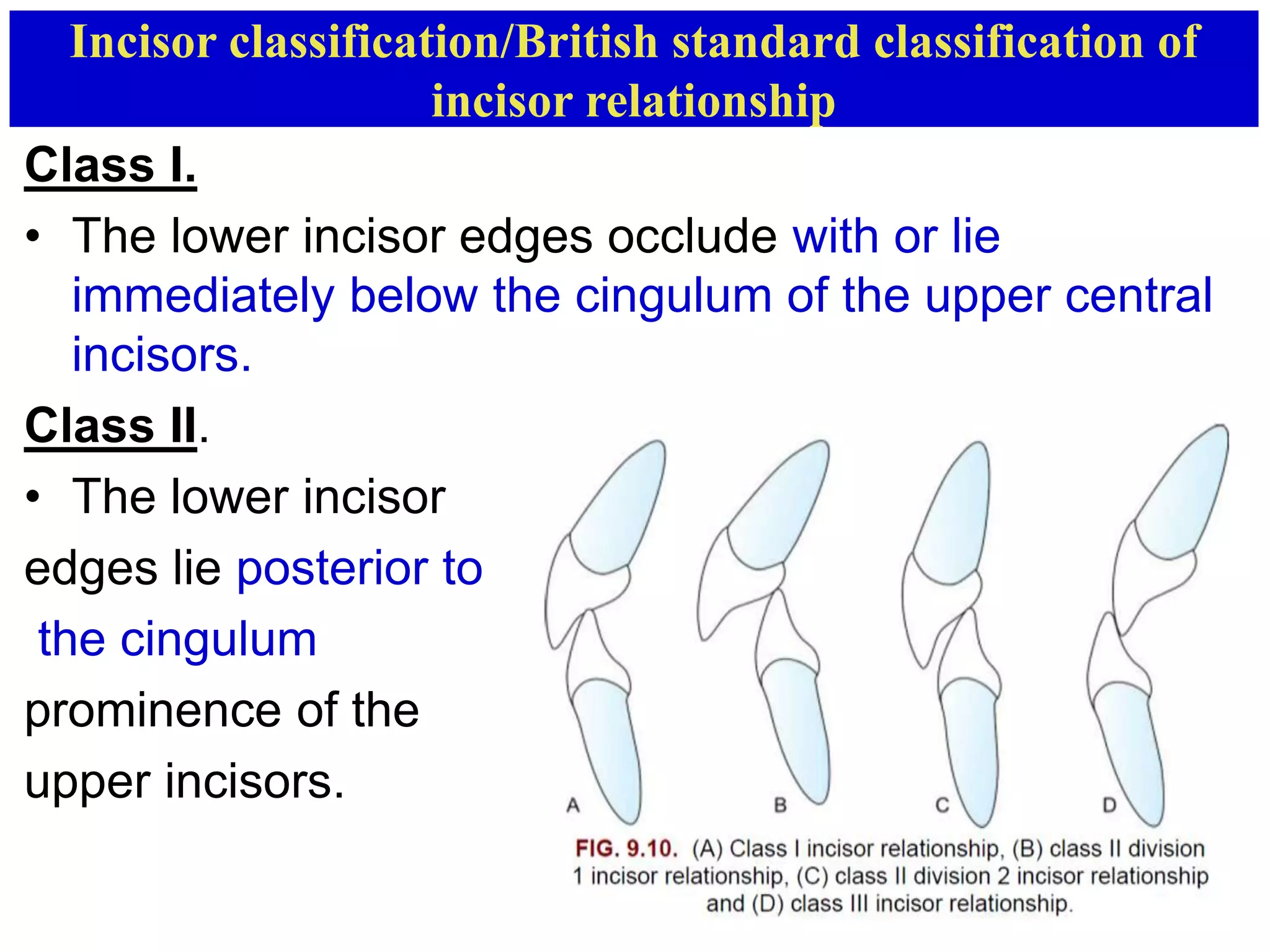 classifcation of malocclusion | PPTX