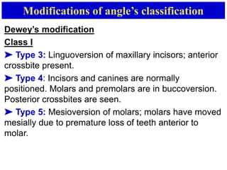 classifcation of malocclusion | PPT