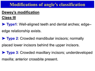 classifcation of malocclusion | PPTX
