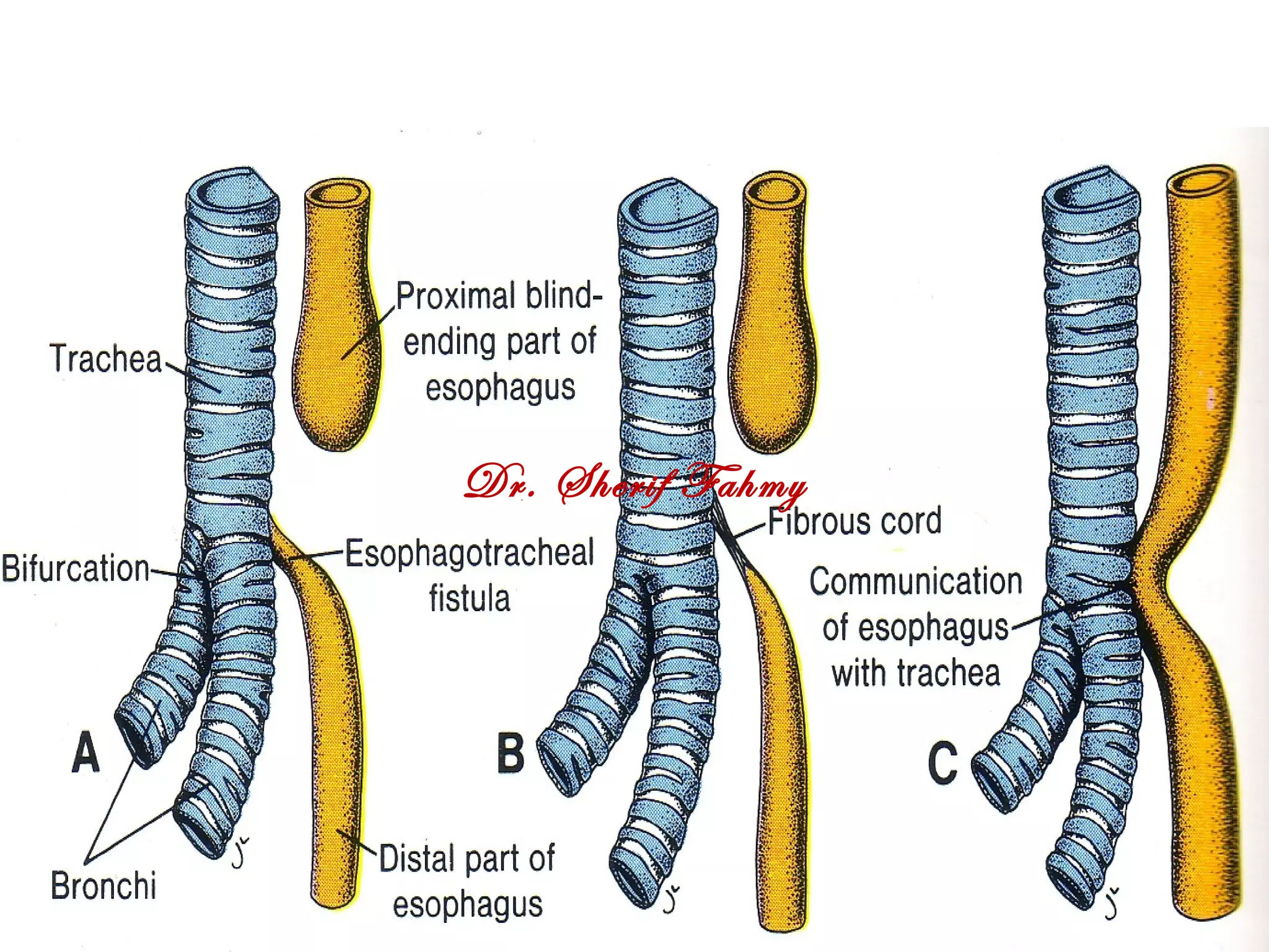 Development of Respiratory System (Special Embryology) | PPS