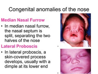 developmentofrespiratorysystem.pptx