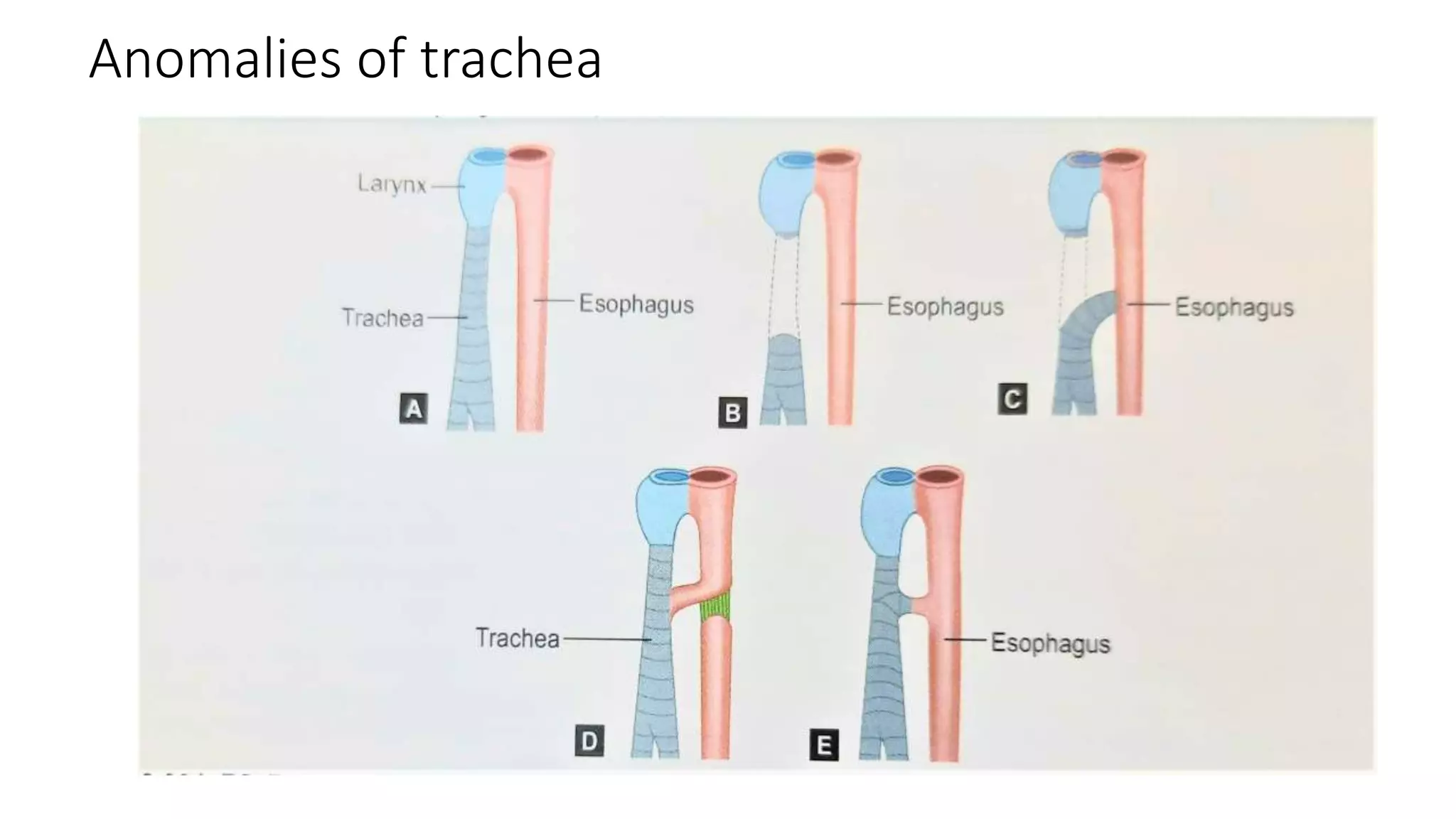 Development of Respiratory System.pptx
