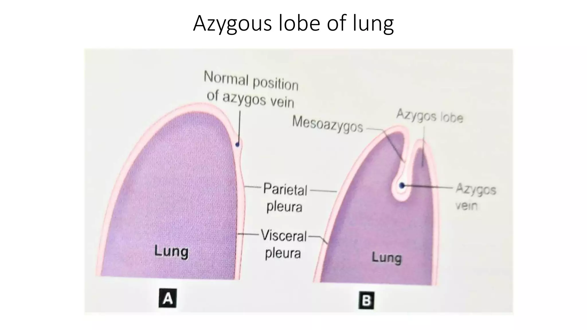 Development of Respiratory System.pptx