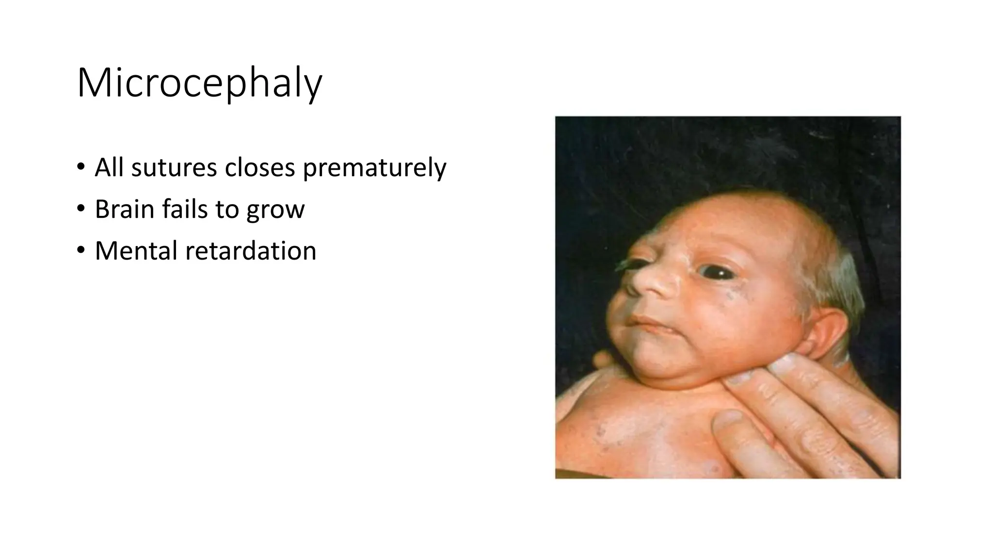 Development of skull embryology copy.pptx