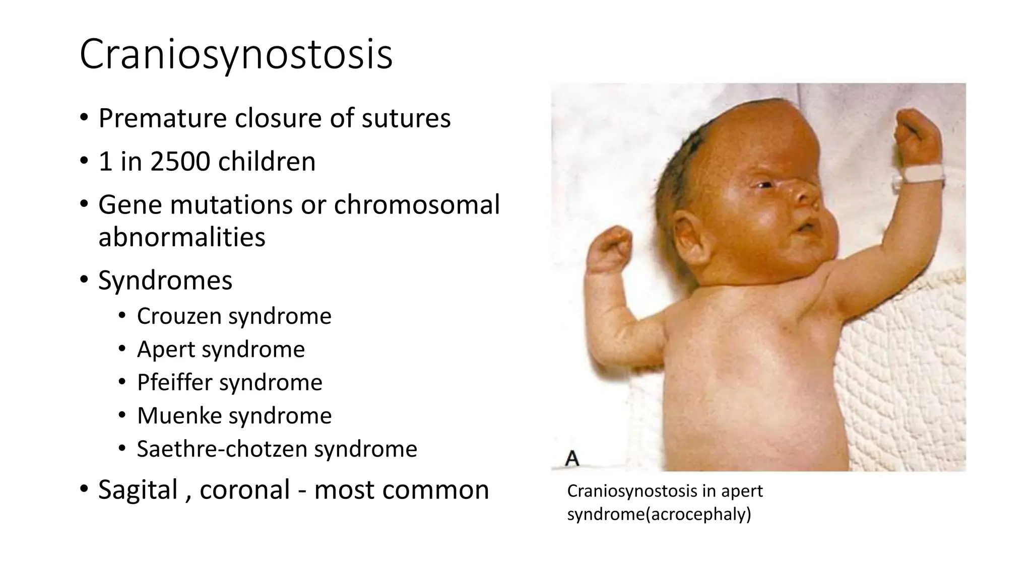 Development of skull embryology copy.pptx