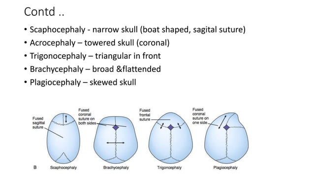Development of skull embryology copy.pptx