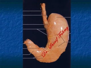 Development of Stomach (Special Embryology) | PPS
