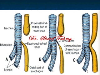 Development of Stomach (Special Embryology) | PPS