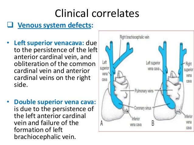 Development of superior venacava and azygous vein