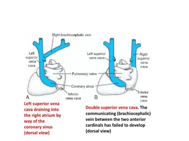 Development of superior venacava and azygous vein