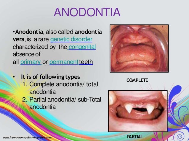 Development of teeth