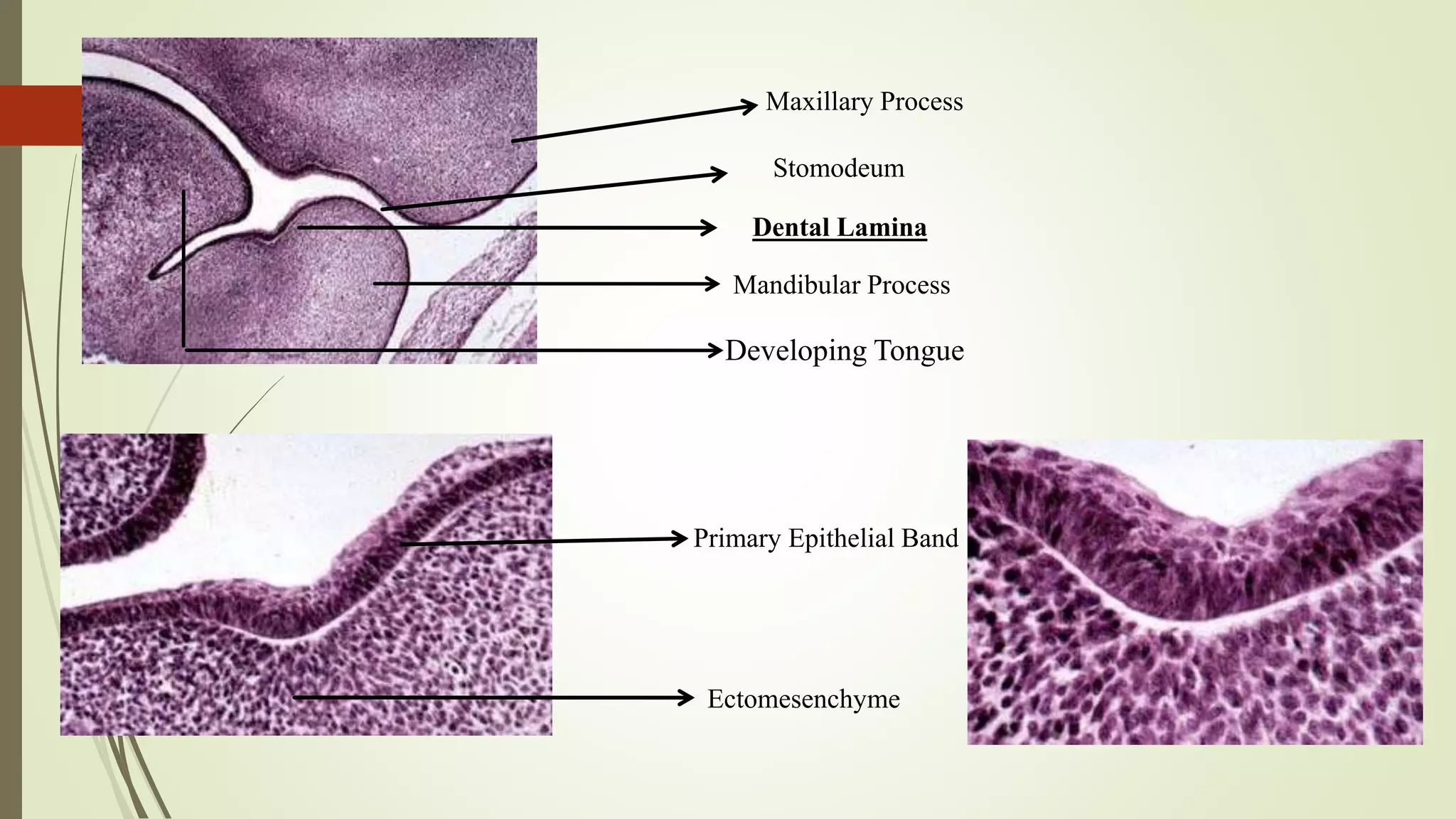 Development Of Teeth | PPTX