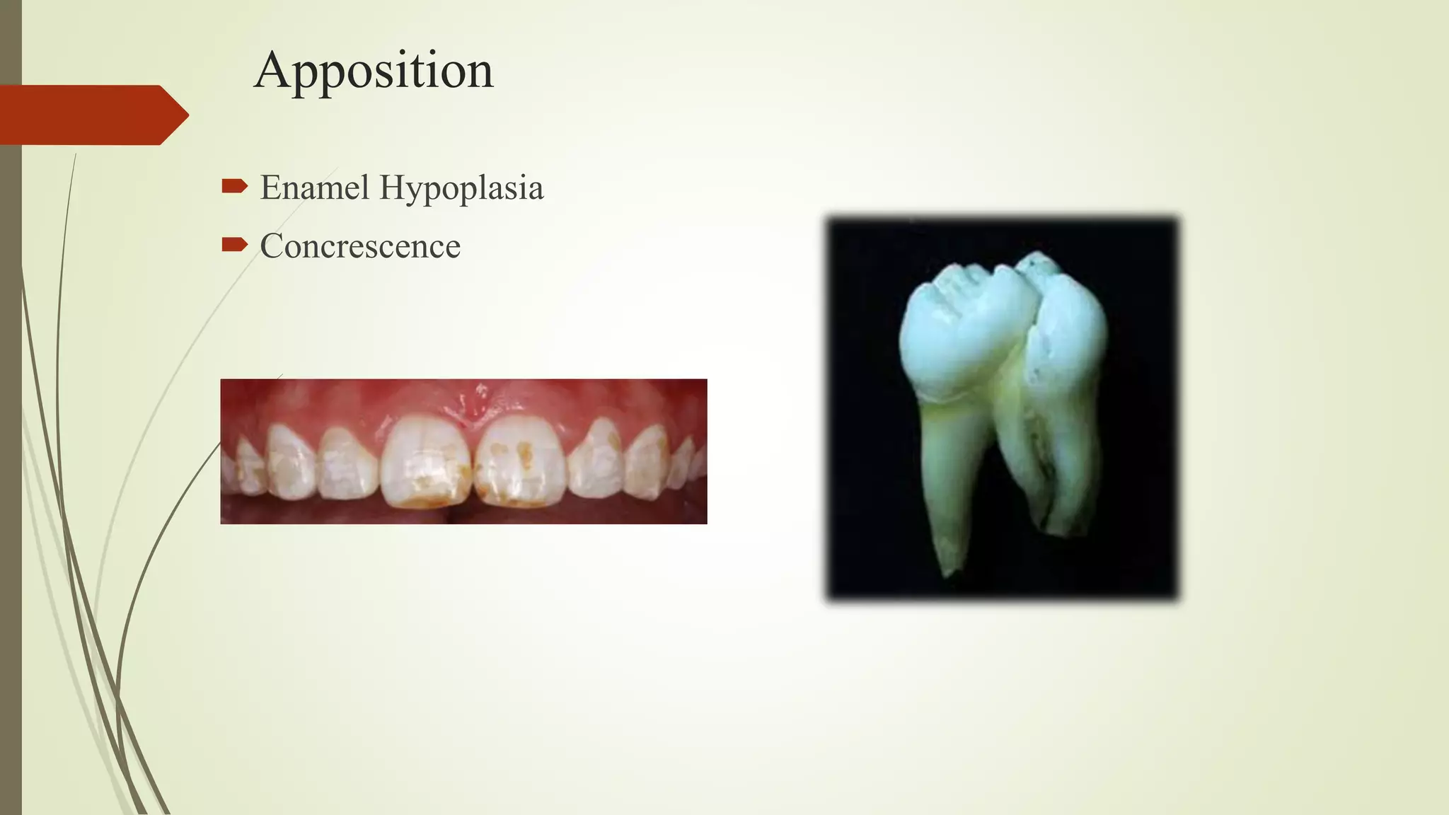 Development Of Teeth | PPTX