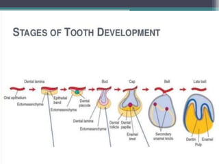 Development of teeth and its clinical significance | PPTX | Dental ...