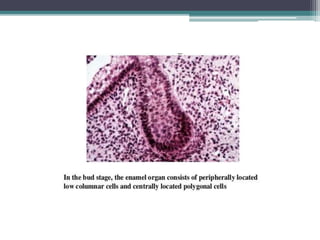 Development of teeth and its clinical significance | PPTX