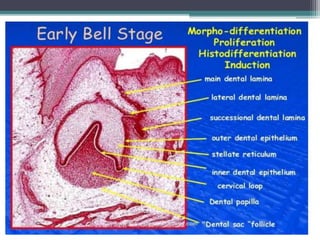 Development of teeth and its clinical significance | PPTX