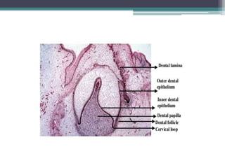 Development of teeth and its clinical significance | PPTX
