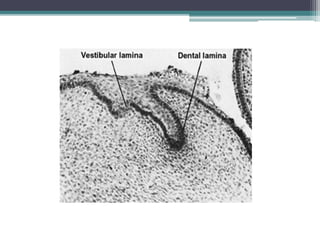 Development of teeth and its clinical significance | PPTX