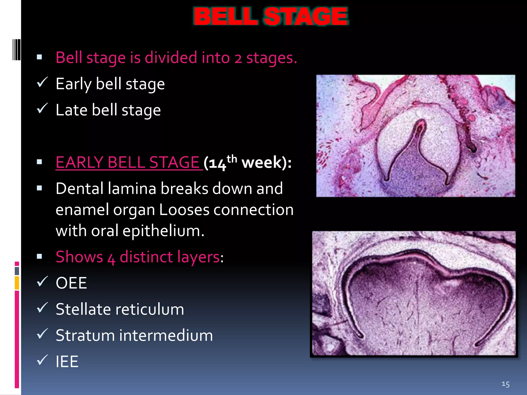 Development of teeth and developmental defects | PPTX