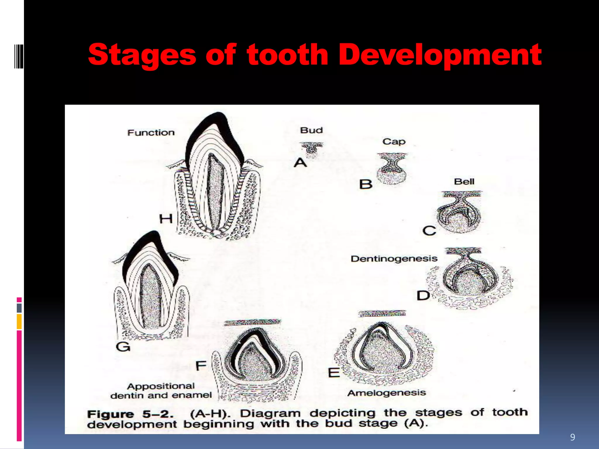 Development of teeth and developmental defects | PPTX