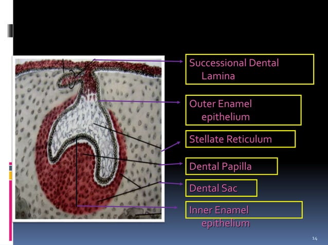 Development of teeth and developmental defects | PPTX