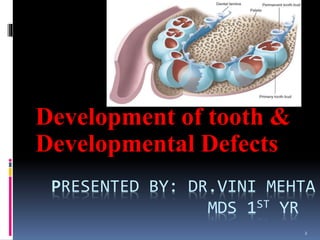 Development of teeth and developmental defects | PPTX