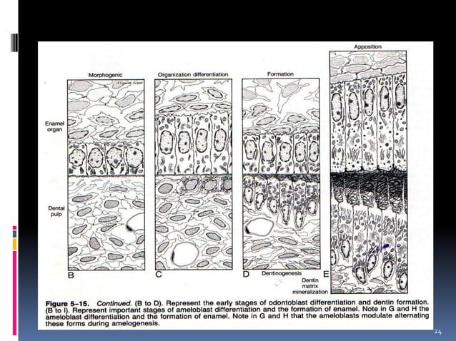 Development of teeth and developmental defects | PPTX