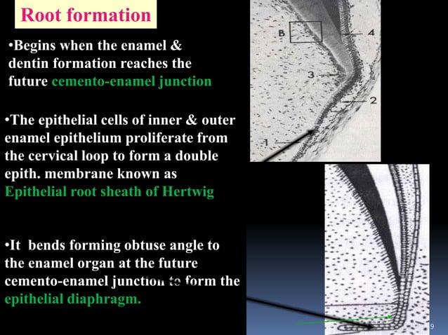 Development of teeth and developmental defects | PPTX