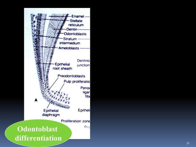 Development of teeth and developmental defects | PPTX