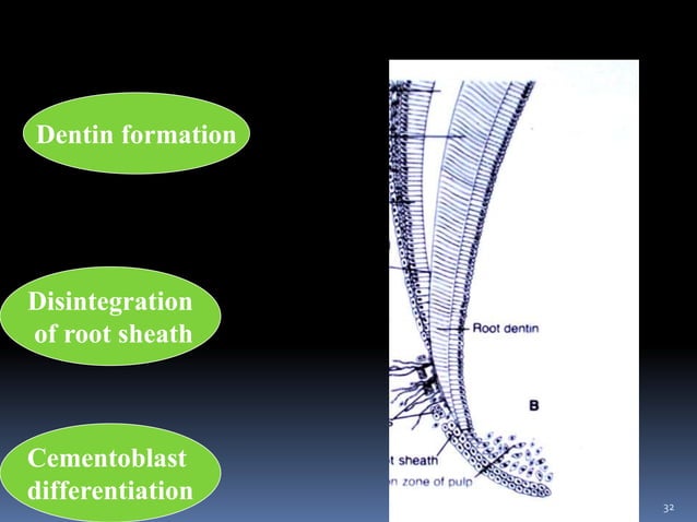 Development of teeth and developmental defects | PPTX