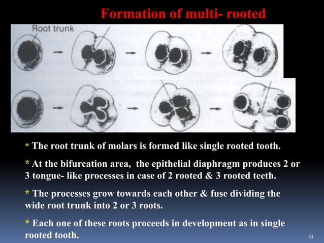 Development of teeth and developmental defects | PPTX