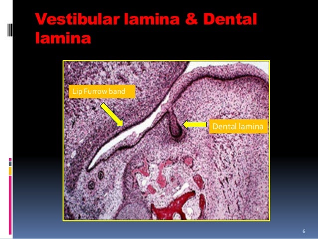 Development of teeth and developmental defects