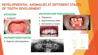 Development of teeth and supporting structures ppt Dr. Vasavi Reddy | PPTX